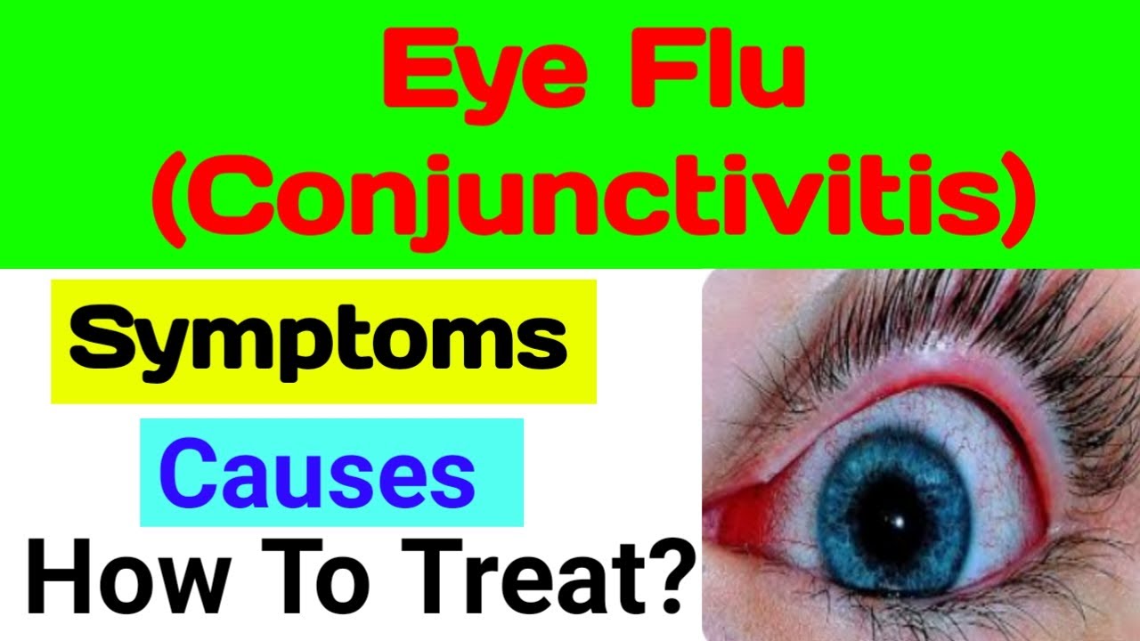 Pink eye | conjunctivitis | conjunctivitis treatment - YouTube