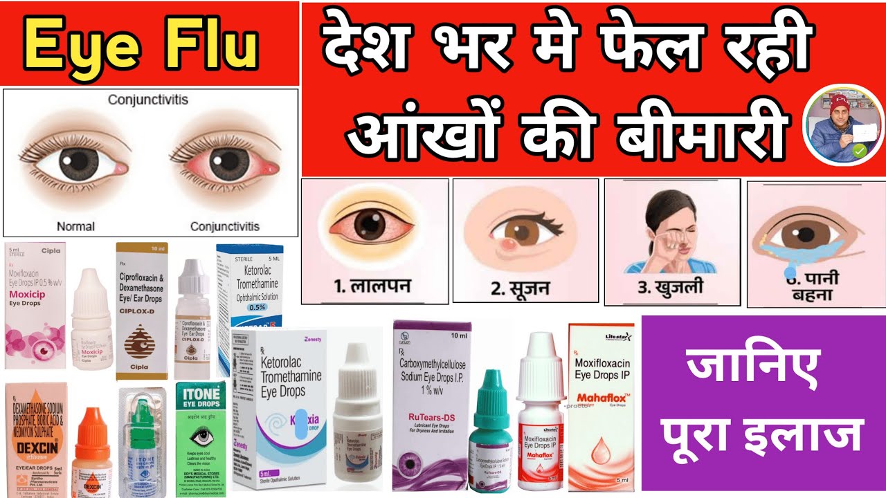 Conjunctivitis। Pink Eye। Eye Flue। Conjunctivitis Treatment - YouTube