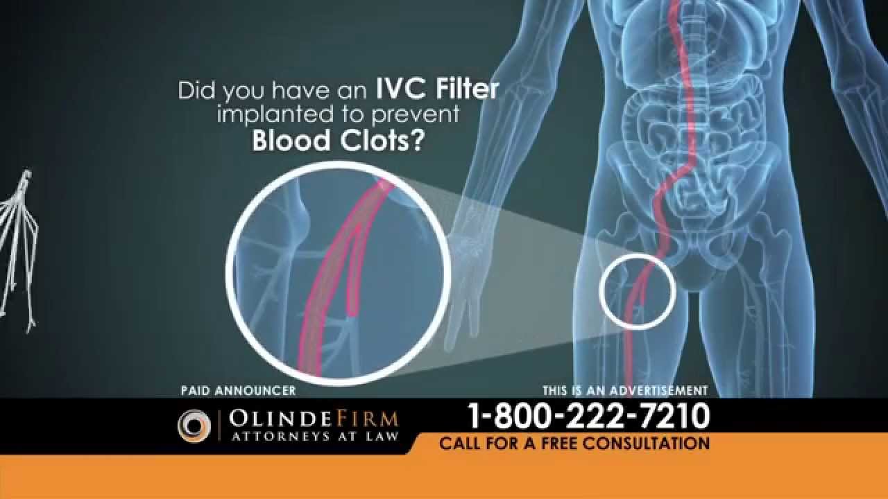 Bard IVC Filters Linked To Serious Complications | Defective Medical ...