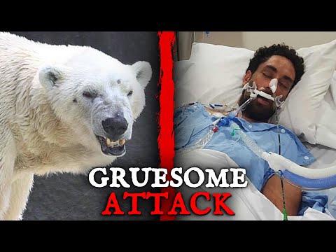 Bear Attack Injuries
