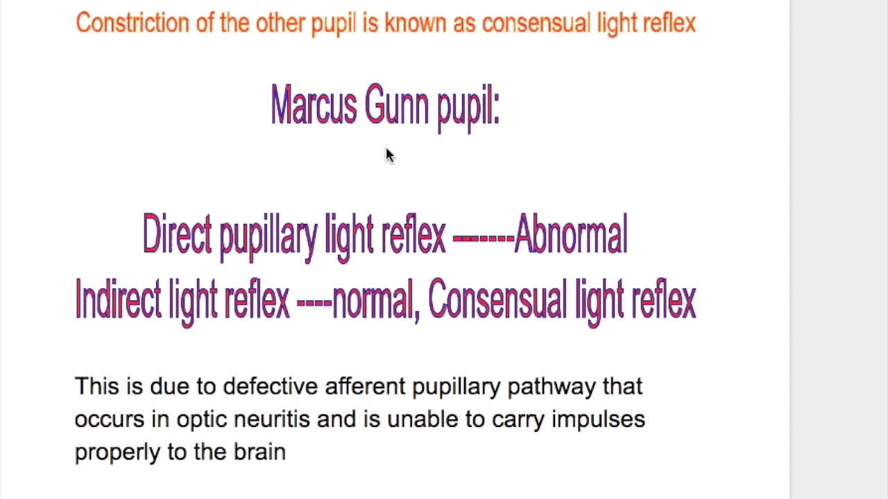 Pupillary light reflex & Marcus Gunn Pupil - YouTube