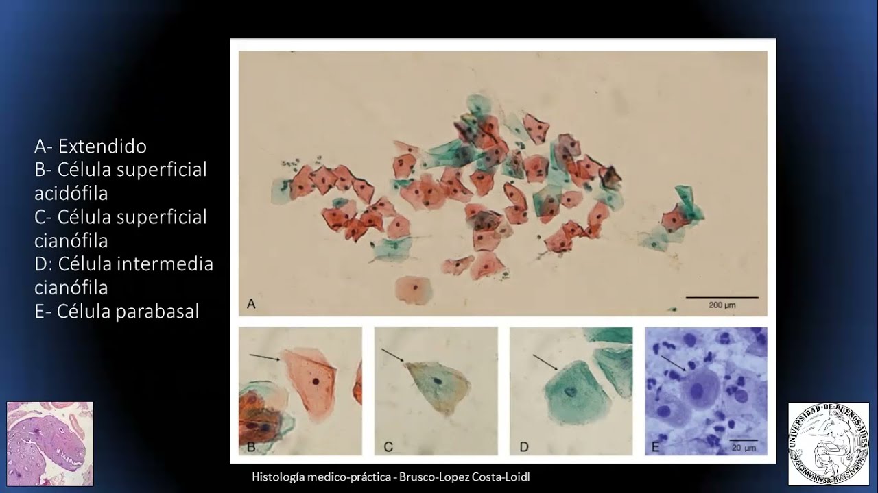 Ciclo endometrial y extendido vaginal - YouTube