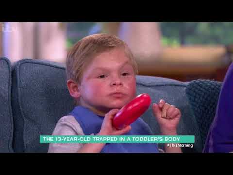 Angus Palmes - The 13 year old trapped in a toddler's body - YouTube