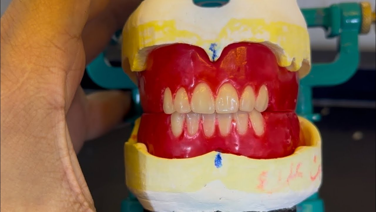 Arrangement ‏/ setting of lower anterior teeth - YouTube