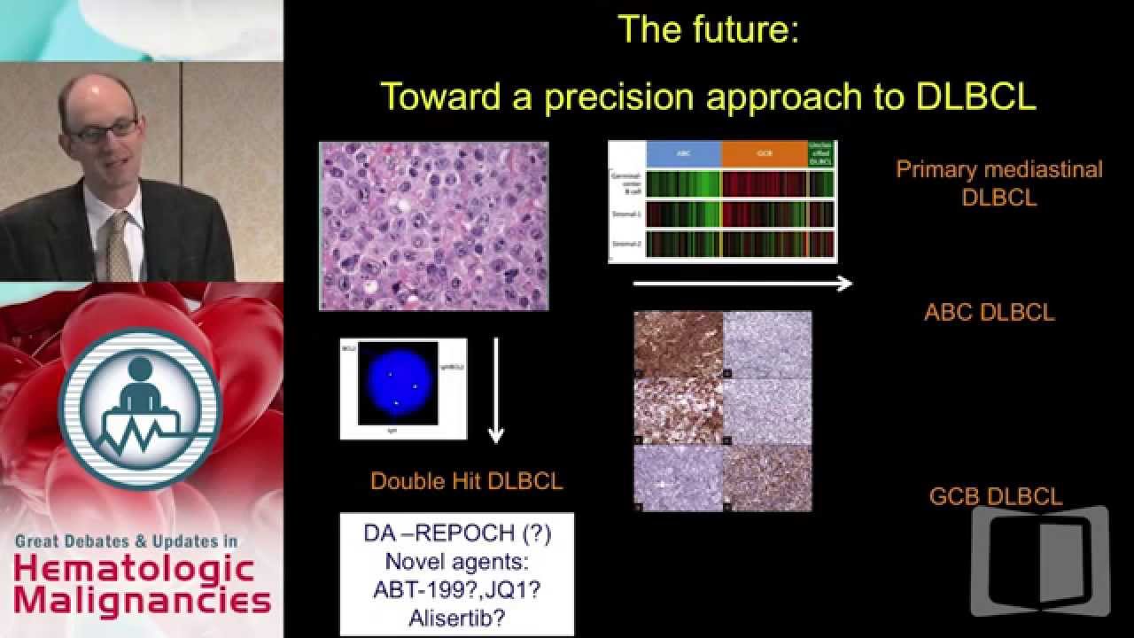 Double Hit Lymphoma - What is it and how should we treat it? - YouTube