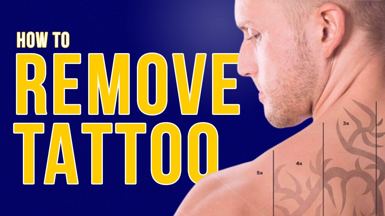 How to remove your tattoo? - YouTube