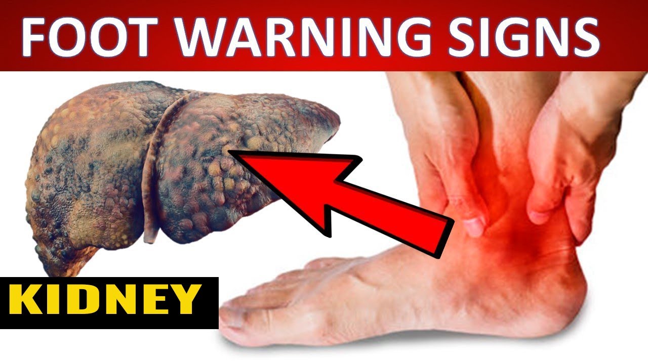 You BETTER... keep an EYE on these foot red flags - YouTube