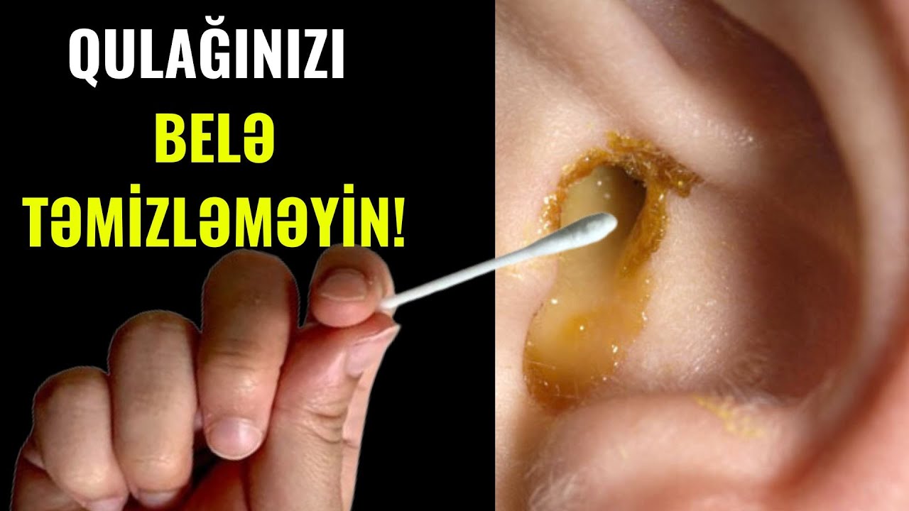 DİQQƏT! Qulaq kirini belə təmizləmək olmaz! Necə təmizlənir? - YouTube