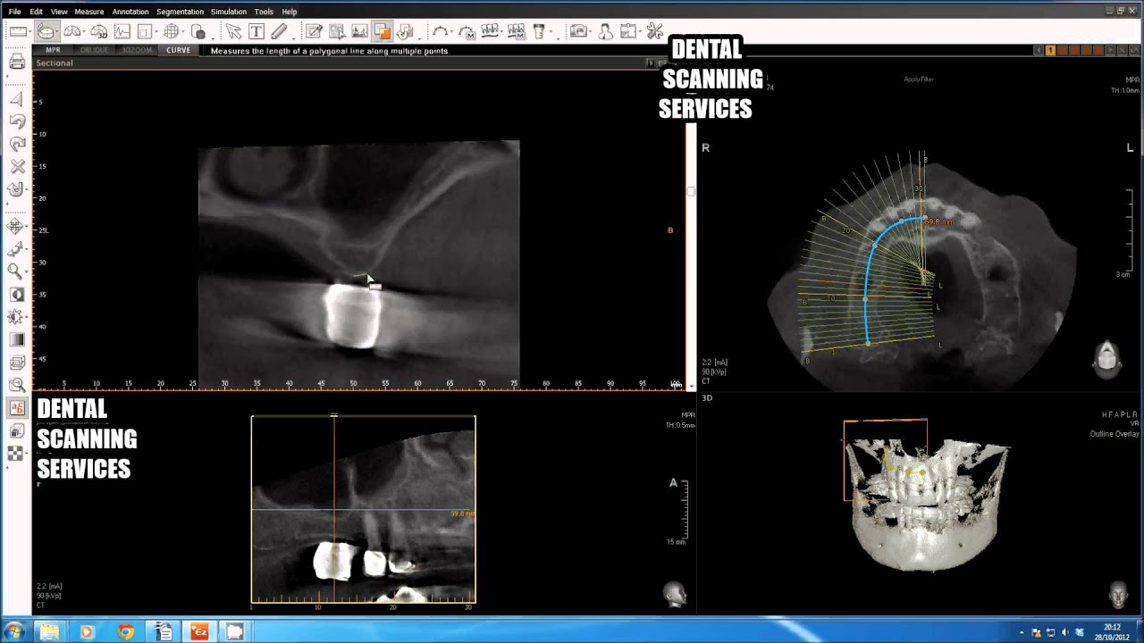 Example CBCT scan being interpreted by Dr Julian Perry. Pt.2 - YouTube