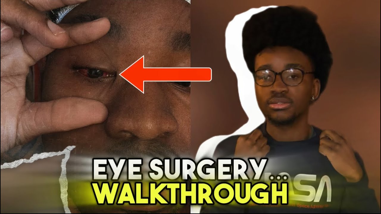 FIXING My Lazy Eyes After 15 YEARS Of Bullying… (EMOTIONAL) - YouTube