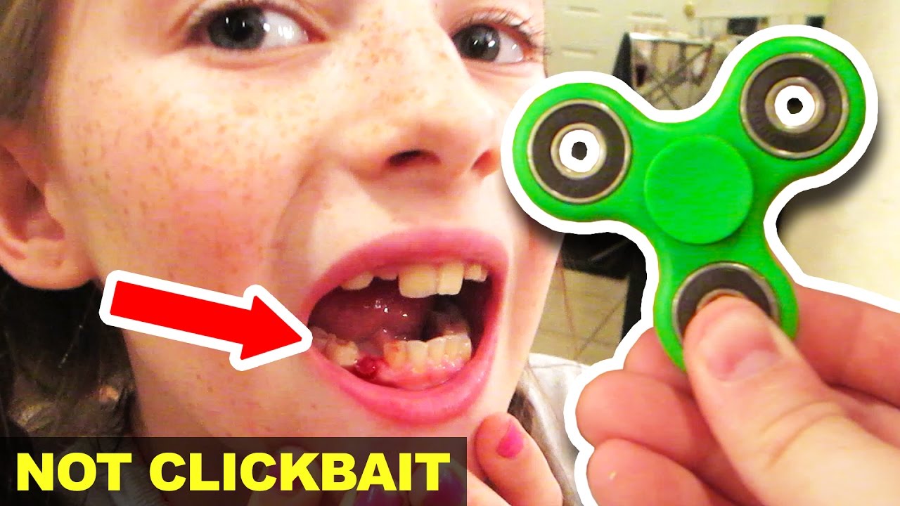 FIDGET SPINNER vs TOOTH! (REAL!) - YouTube