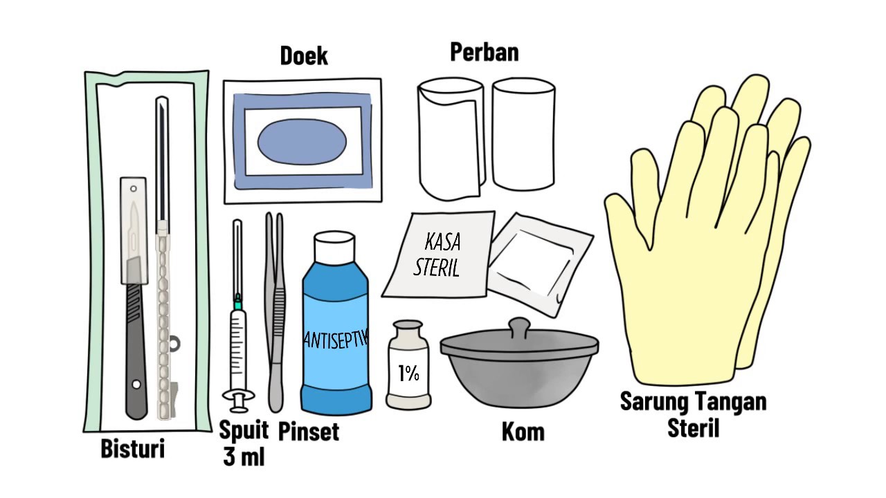 Cara Pemasangan KB Implant Dua Batang - YouTube