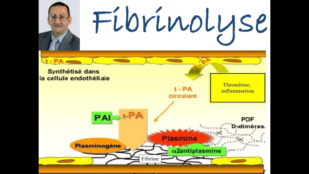 Fibrinolyse - YouTube