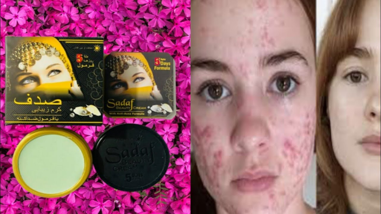 sadaf beutay cream || चहेरा पूरा सुंदर बनाये इस क्रीम से || harbal ...