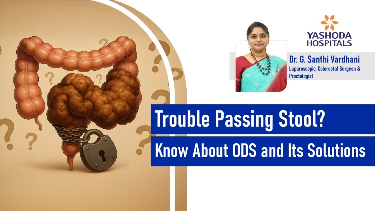 Trouble Passing Stool? Know About ODS and Its Solutions | Dr. G. Santhi ...