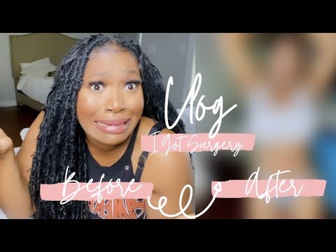 VLOG | I Got Surgery In Miami And This Is What Happened | BBL | 360 ...
