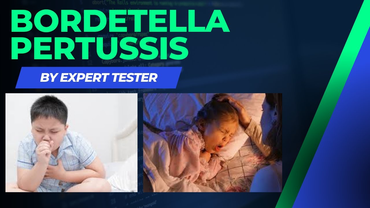 Bordetella pertussis | Causes , Symptoms , Diagnosis , Treatment ...