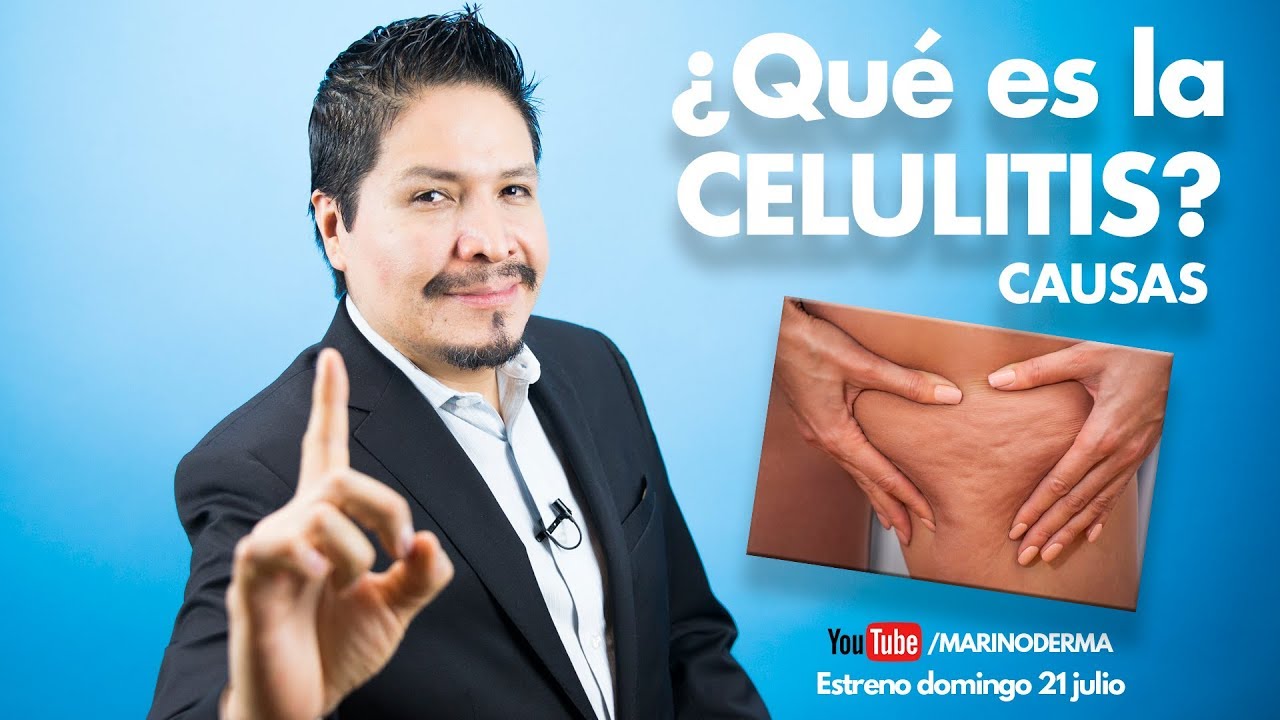 ¿Que es la celulitis y cuales son sus causas? Dr Marino Dermatólogo ...