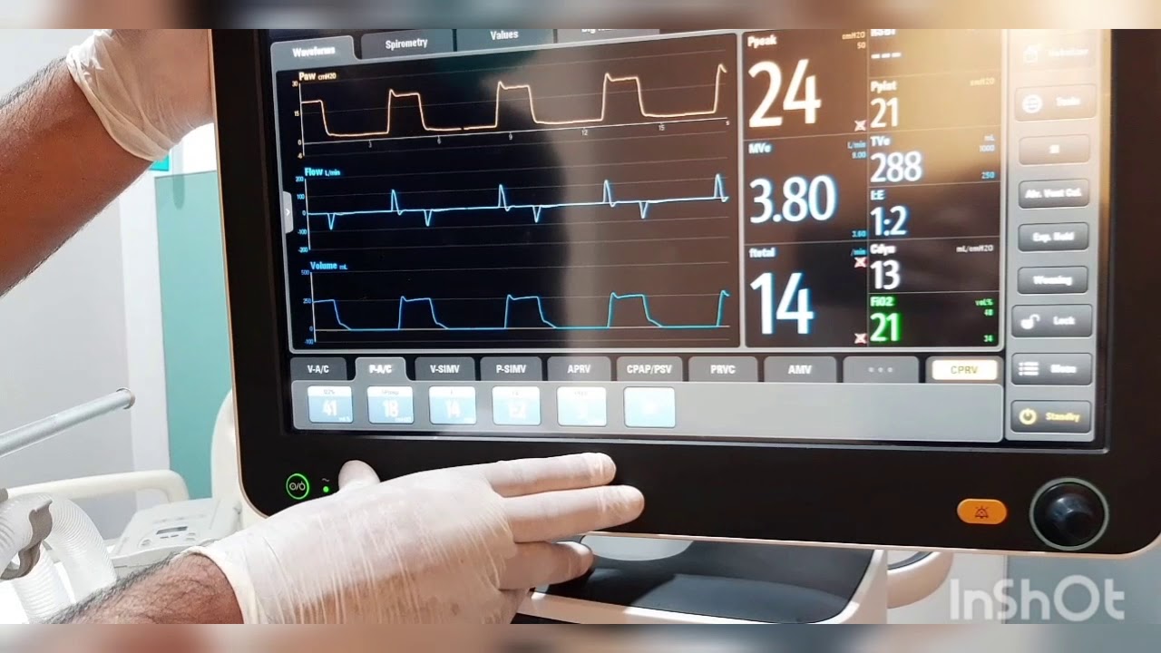 Demonstration of sv800 mindray ventilator - YouTube