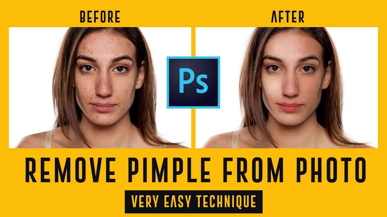 Remove pimples from Photos using Photoshop- Photo Retouching - YouTube