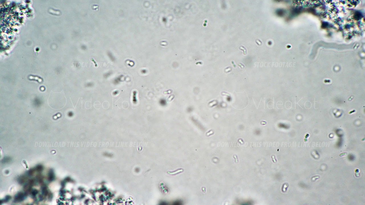 Lactic acid bacteria are slowly flowing in the dairy product under the ...