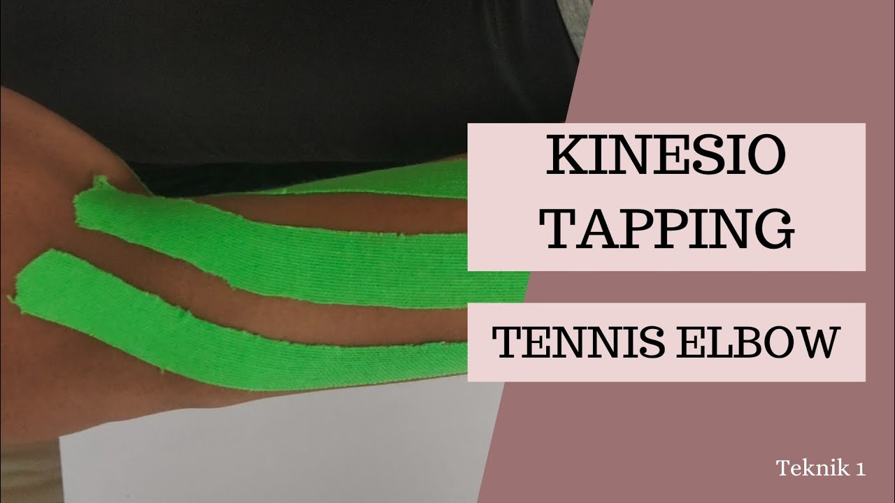 KINESIO TAPPING PADA TENNIS ELBOW. Teknik 1 - YouTube