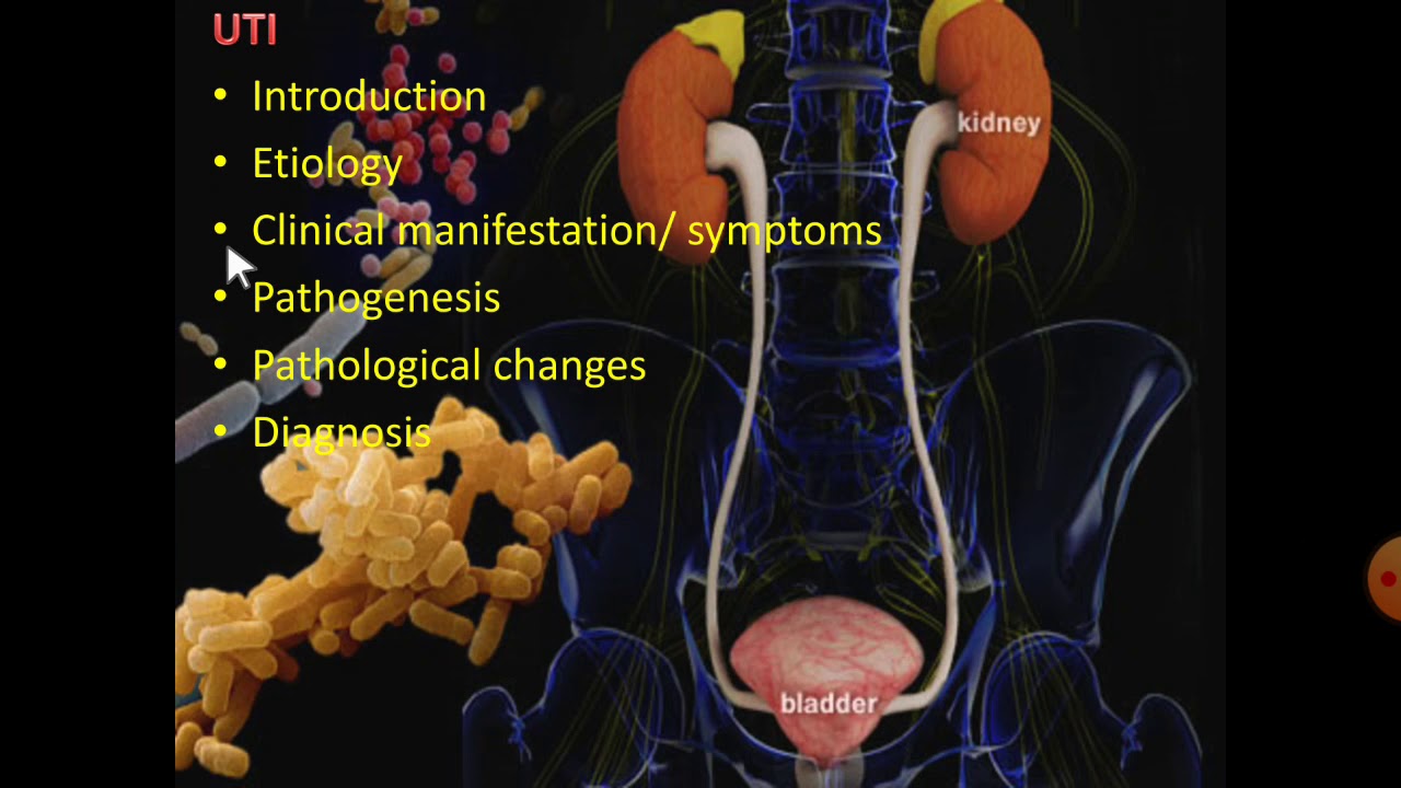 Urinary Tract Infection Discharge