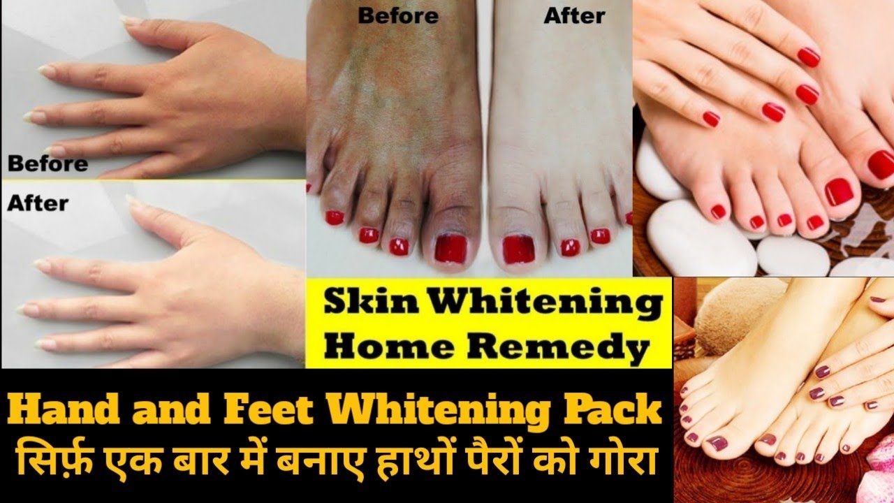 Hand and Feet Whitening bleach at home | Best hand and foot whitening ...