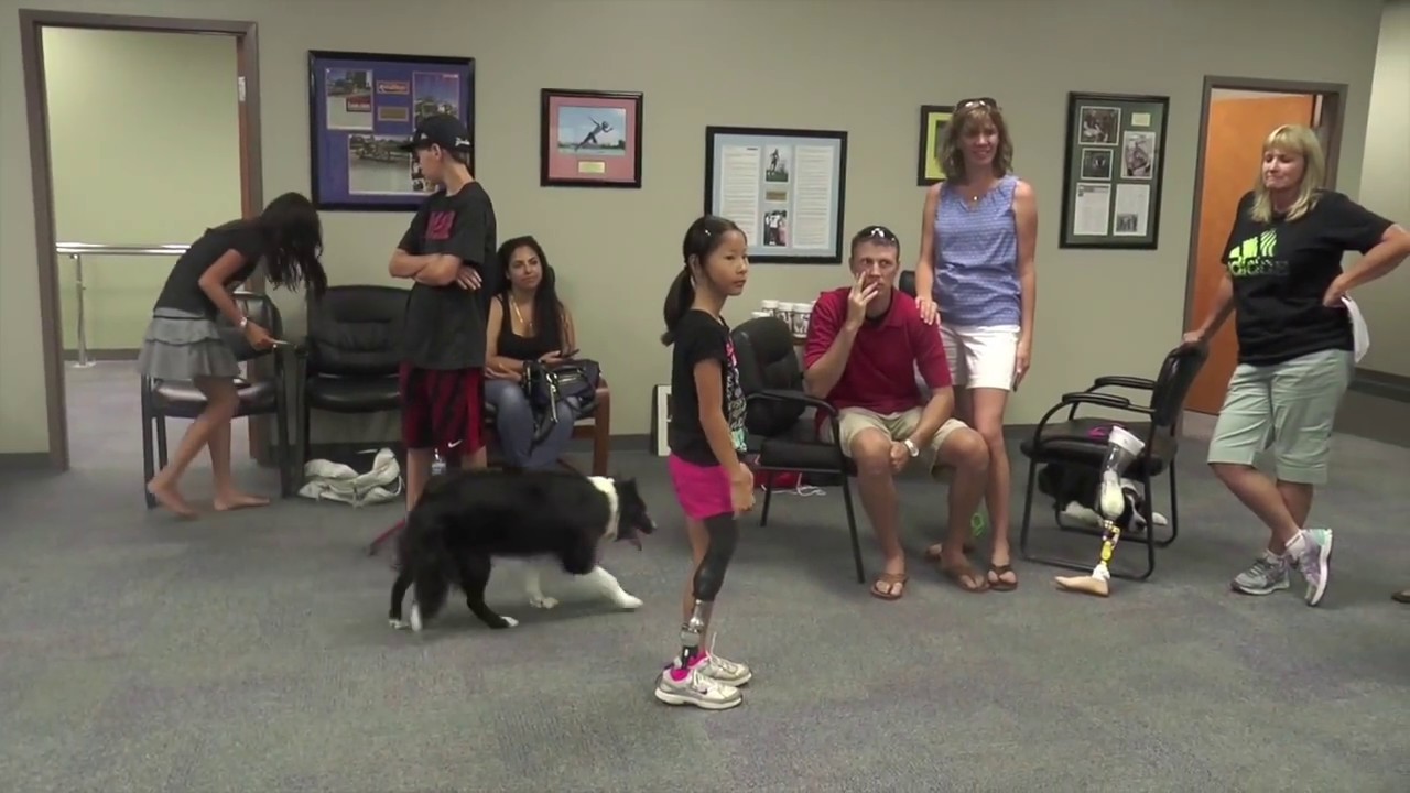 Ellie, PFFD Amputee - YouTube