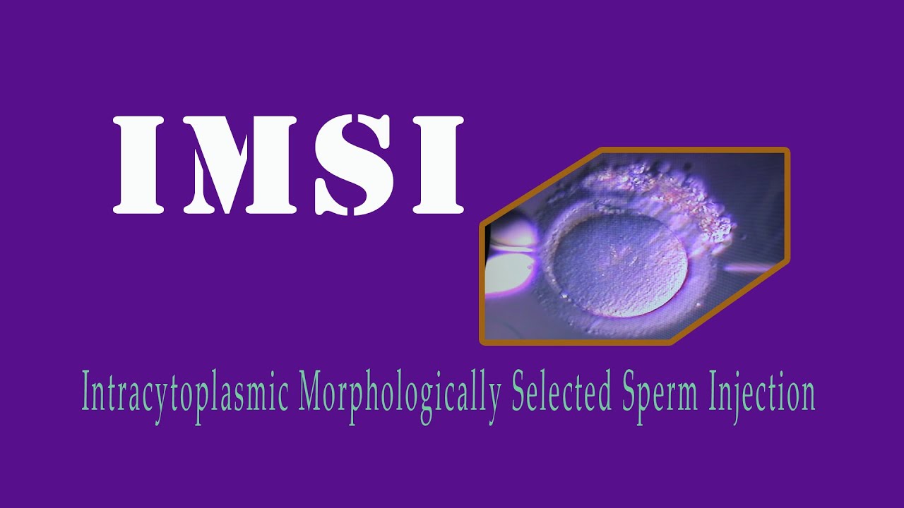 IMSI - Intracytoplasmic Morphologically Selected Sperm Injection - YouTube