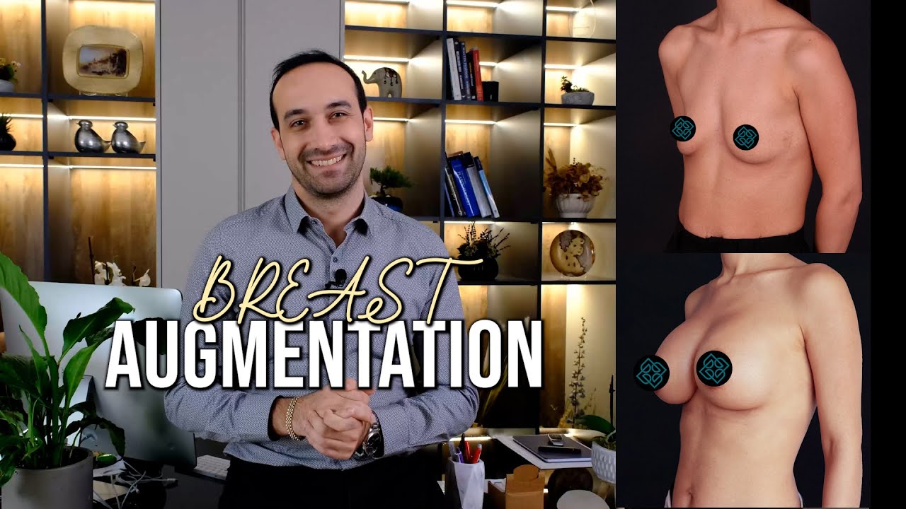 Breast Augmentation: Everything You Must Know - Dr. Burak Pasinlioğlu - YouTube
