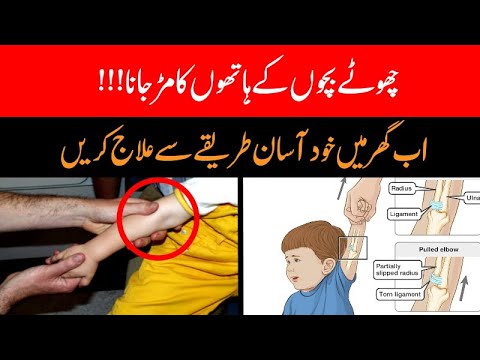What is Pulled Elbow || Treatment Of Pulled Elbow || Reduction of ...