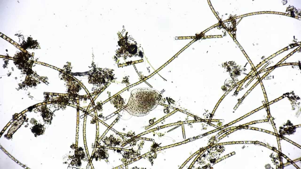 🔬 Mikroorganismus - microcosmos - microorganism - life in a puddle ...
