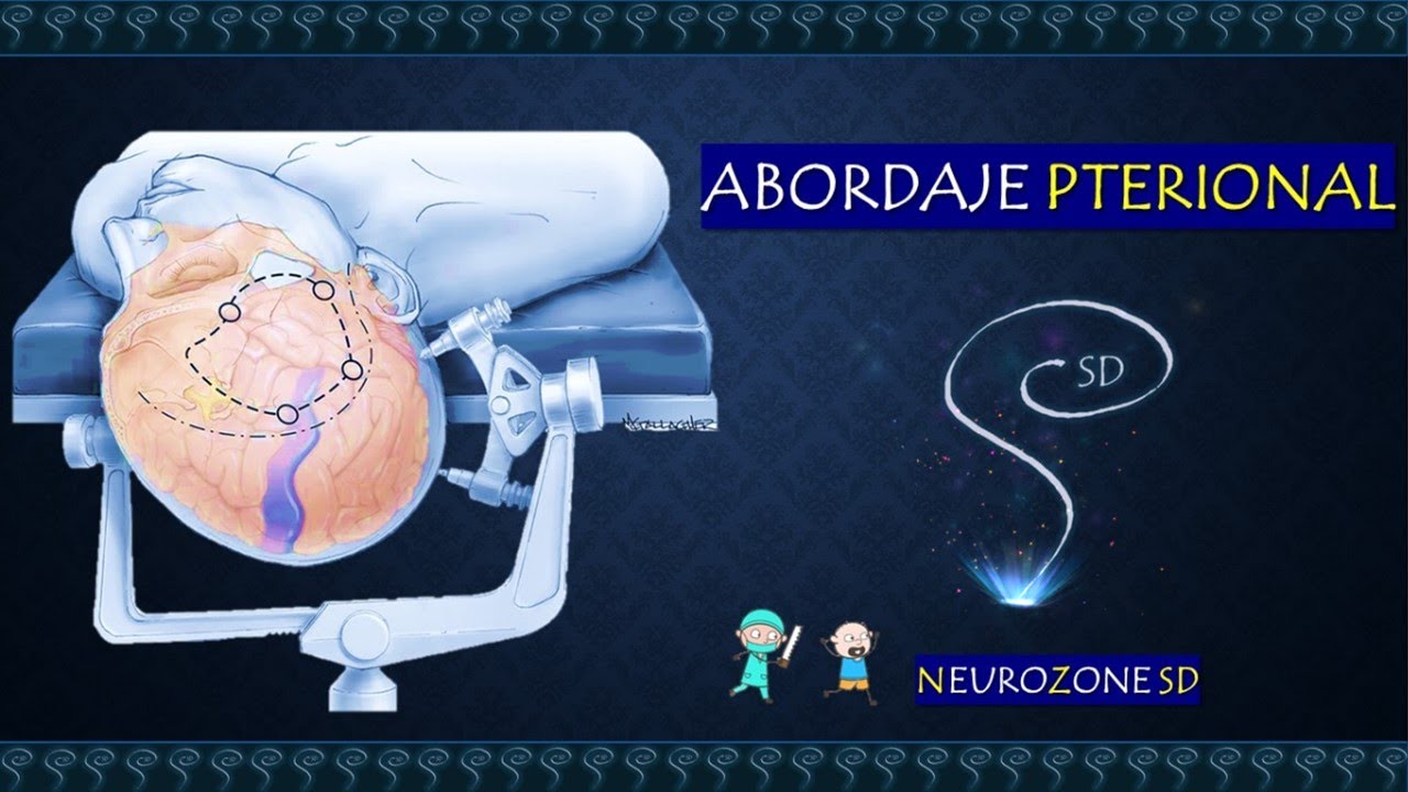 Abordaje Pterional - YouTube