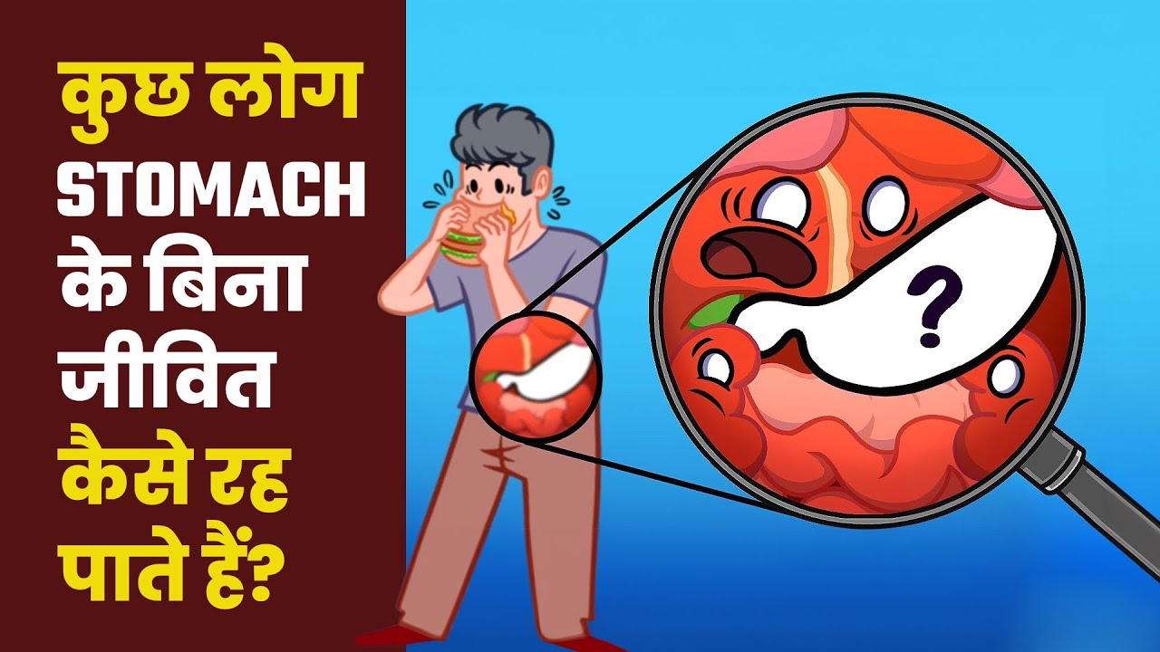 क्या Stomach के बिना जीवित रहना मुमकिन है? || Is it possible to live ...