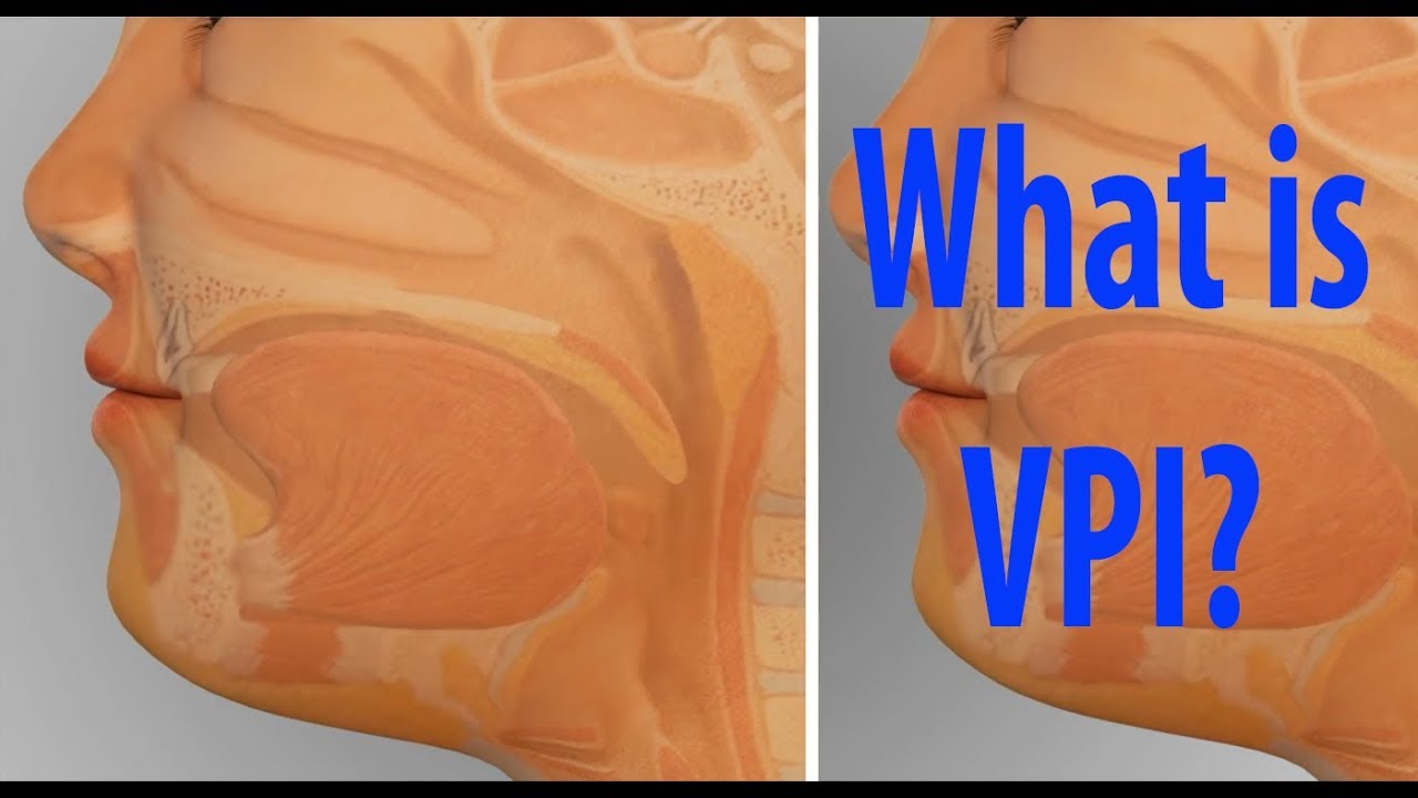 What is VPI (Velopharyngeal Insufficiency)? - YouTube