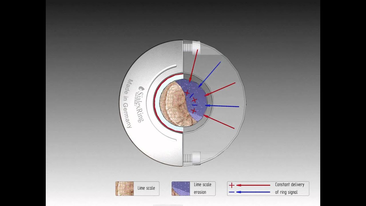 Sialex®-Ring - YouTube
