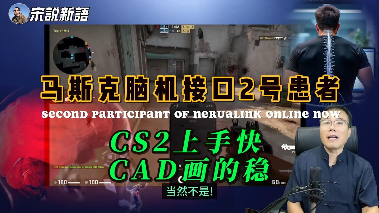震撼！Neuralink 2号植入者Alex：破世界纪录、玩CS2、用CAD设计，脑机接口重塑生活 - YouTube