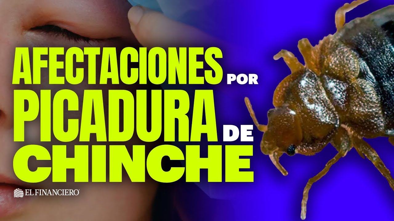 Esta es la enfermedad de Chagas, transmitida por CHINCHES - YouTube
