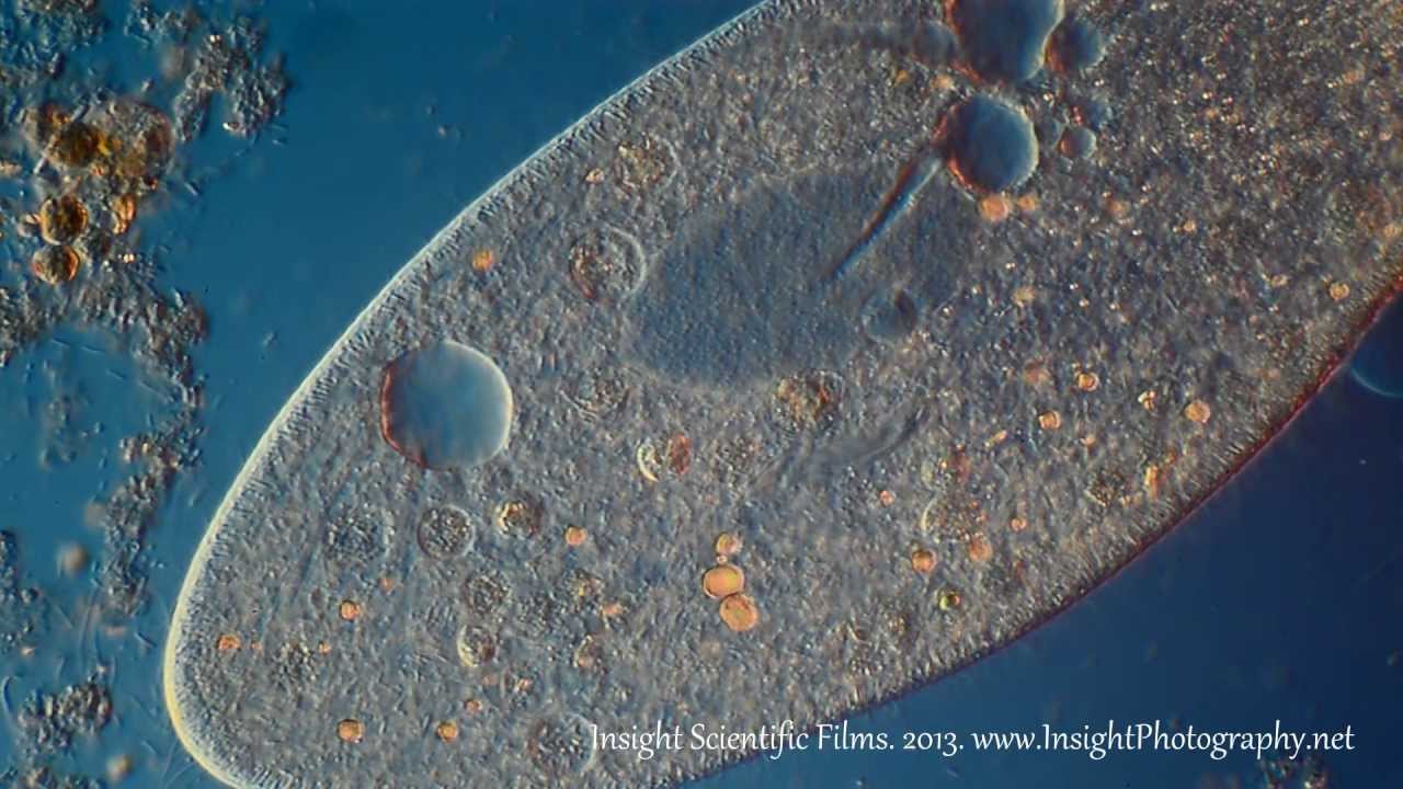 Paramecium bursaria, P. caudatum, Oxytricia. 400-1000X, DIC. - YouTube