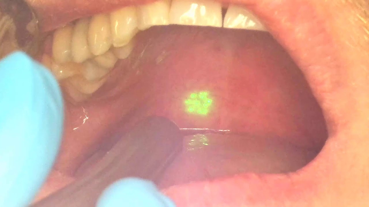 Solea Sleep Protocol- Dr. Anthony Bolamperti - YouTube