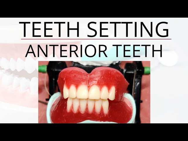 Anterior Tooth