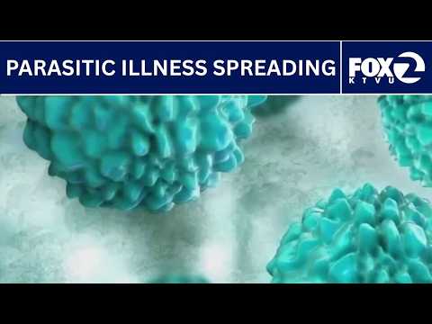 Parasite causing major stomach symptoms is spreading | KTVU