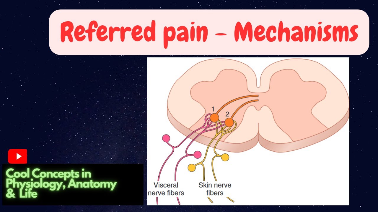 12 (c). Mechanism of Referred Pain | Sensory CNS Physiology | 2nd YR ...