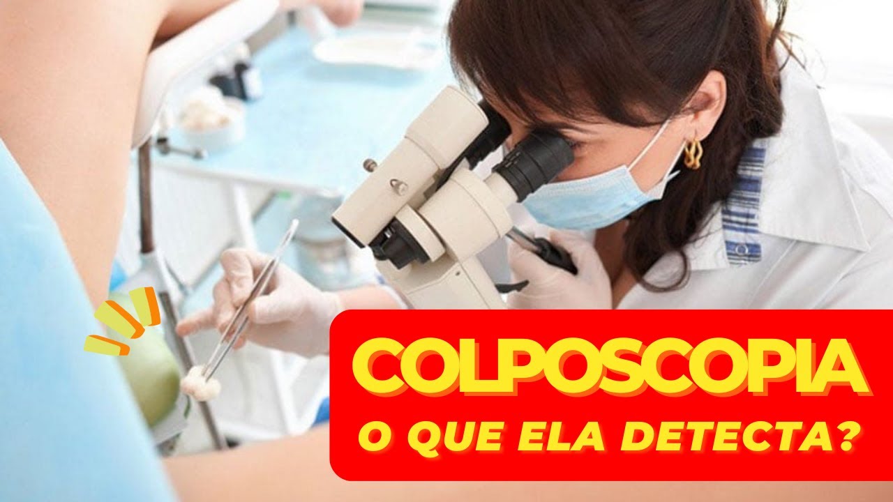 Colposcopia: o que esse exame detecta? - YouTube
