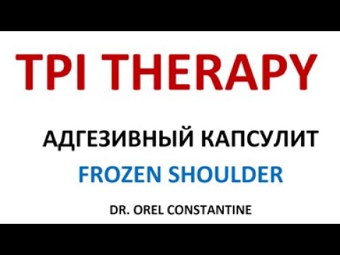 Адгезивный капсулит ( Frozen shoulder with calcific tendinitis of m ...