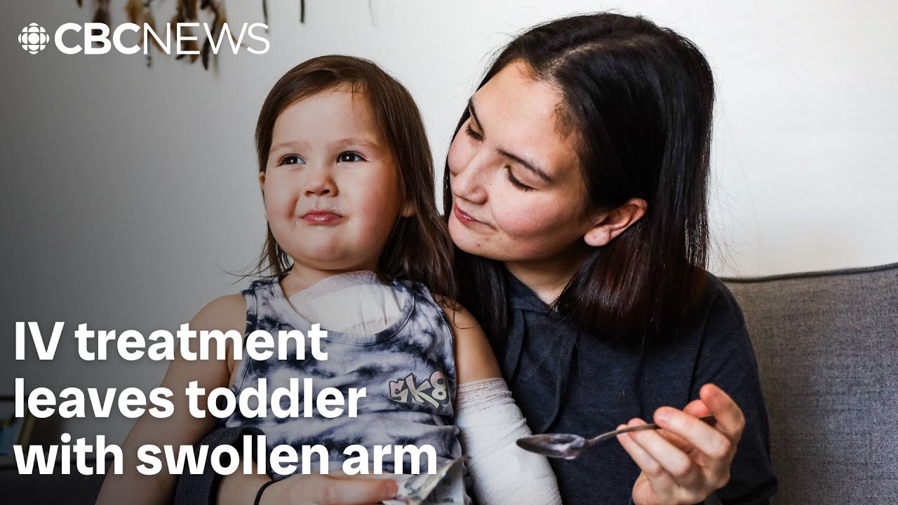 IV treatment leaves toddler with swollen arm - YouTube