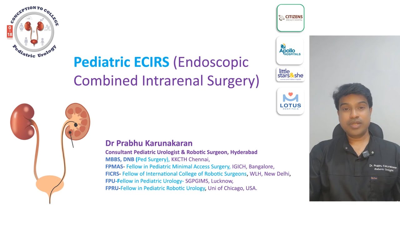 Pediatric ECIRS( Endoscopic Combined Intrarenal Surgery) for complex ...