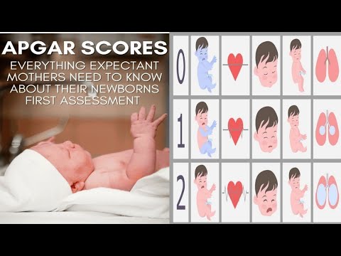 APGAR SCORE (Assessment of Newborn)||Easy Explanation - YouTube