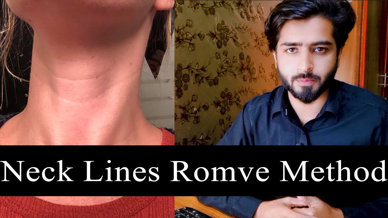 How To Remove Neck Lines Neck Lines Treatment DFL YouTube how-to-remove-neck-lines-neck-lines-treatment-dfl-youtube